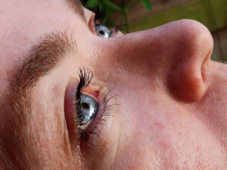 how to get rid of a cyst on your face – Freelance Web Developer – Abdul